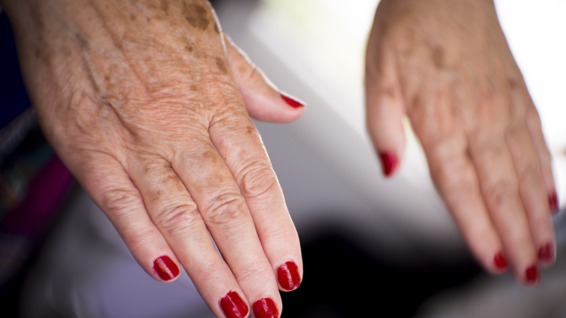 Zeldzame Ziektendag: niemand zou zich alleen moeten voelen