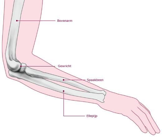Operatie aan je elleboog