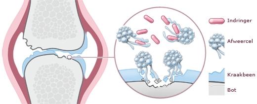 Over reumatoïde artritis (RA)